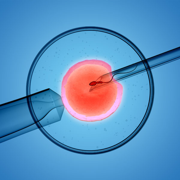 How IVF Works; Here's All You Need To Know